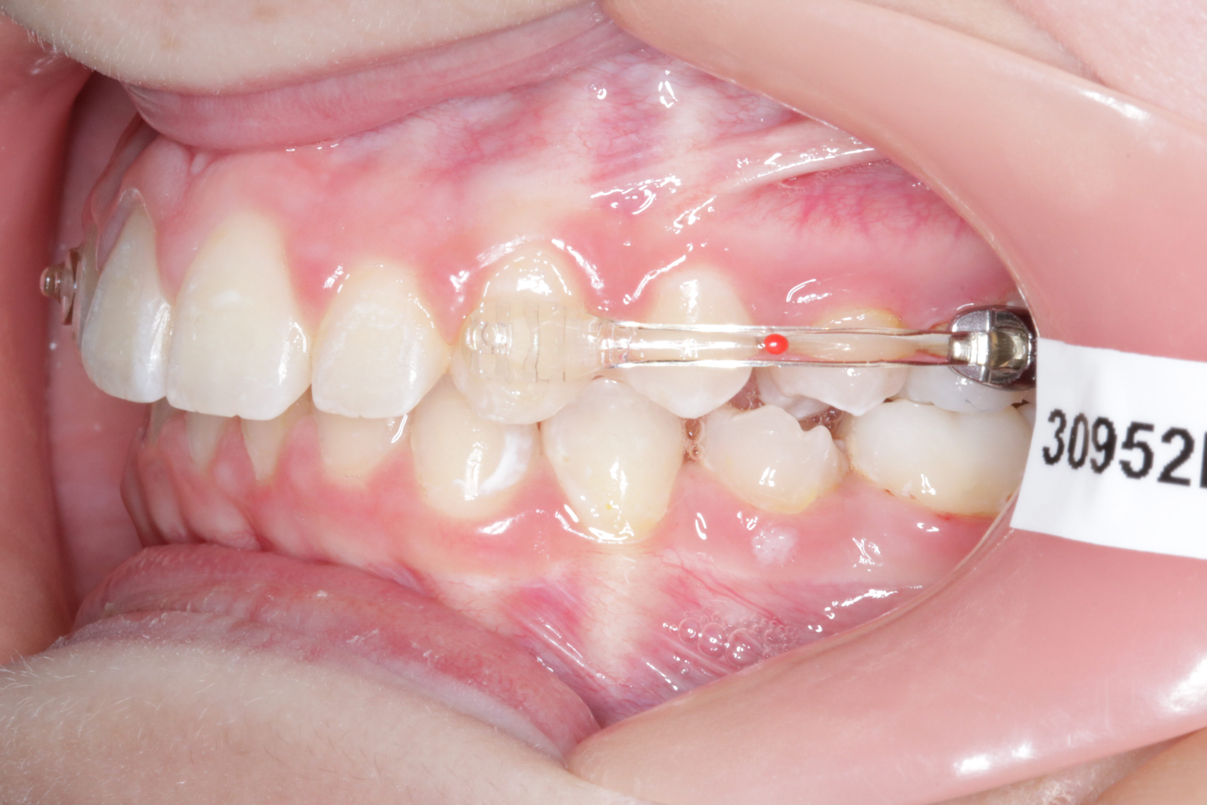 Dental News - Boosting facial aesthetics through a hybrid approach of ...